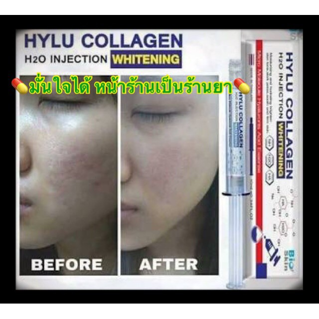 Bio Skin Hylu Collagen เซรั่มหน้าใสเมโสแบบเกาหลี ภายใน 1 คืน 10ml ...