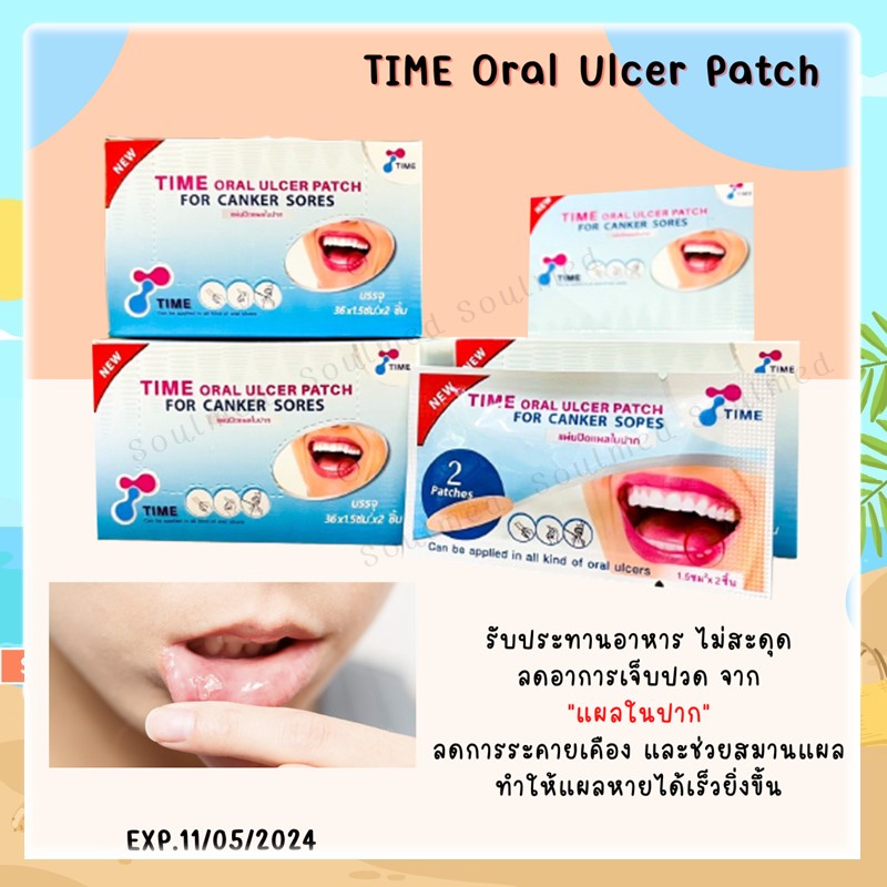 Time oral ulcer patch แผ่นแปะแผลในปาก แผลร้อนใน แก้ปวดแผลกัด แผลกระแทก ...