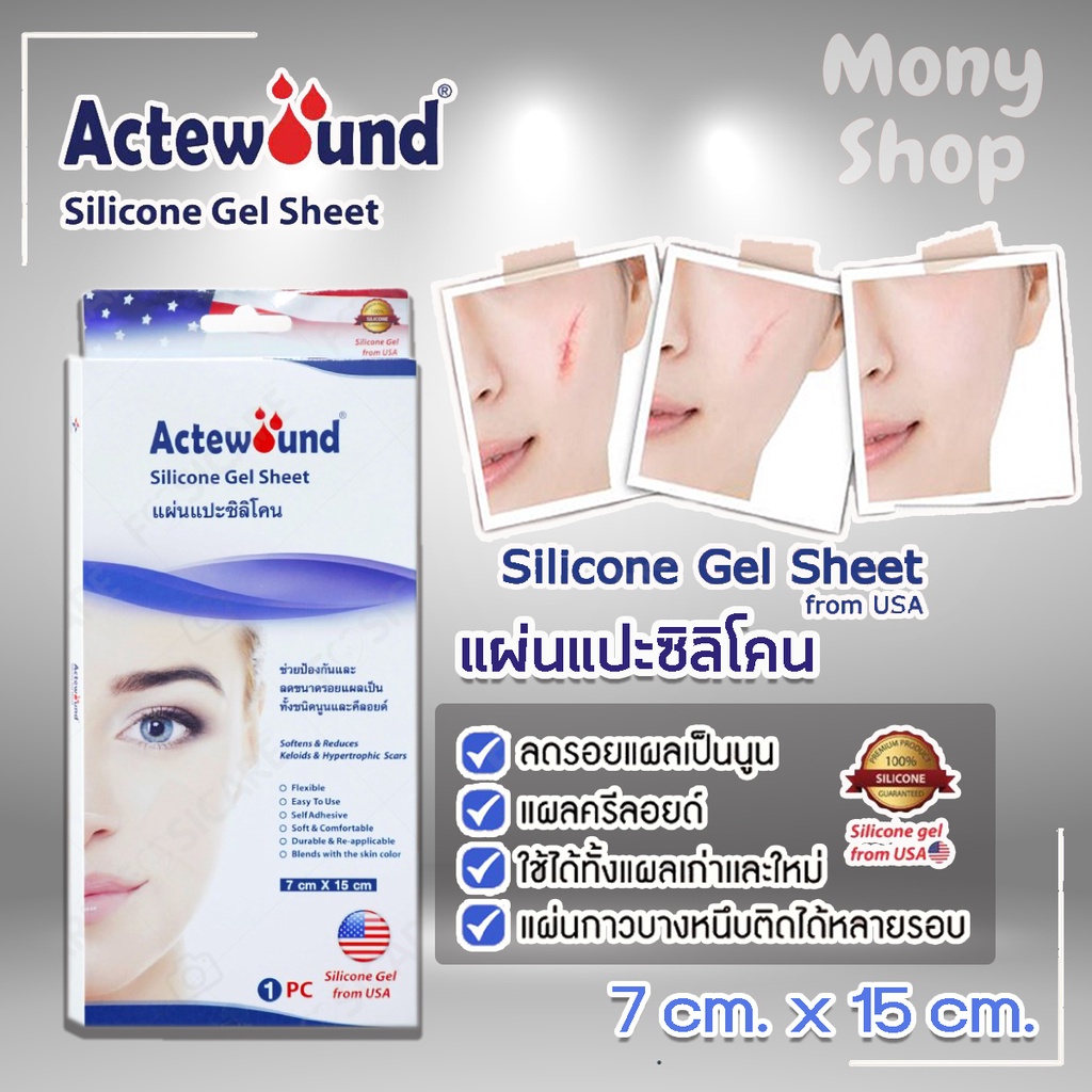 Actewound Silicone Gel Sheet ขนาด 7cm x 15cm (1กล่อง) แผ่นแปะซิลิโคน ...