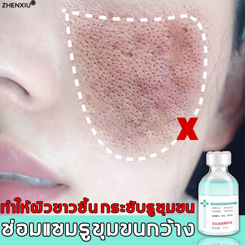 ZHENXIU เซรั่ม 32ml เซรั่มไฮยาไวท์เทนนิ่ง ทำให้ผิวขาวขึ้น เติมเต็มความ ...