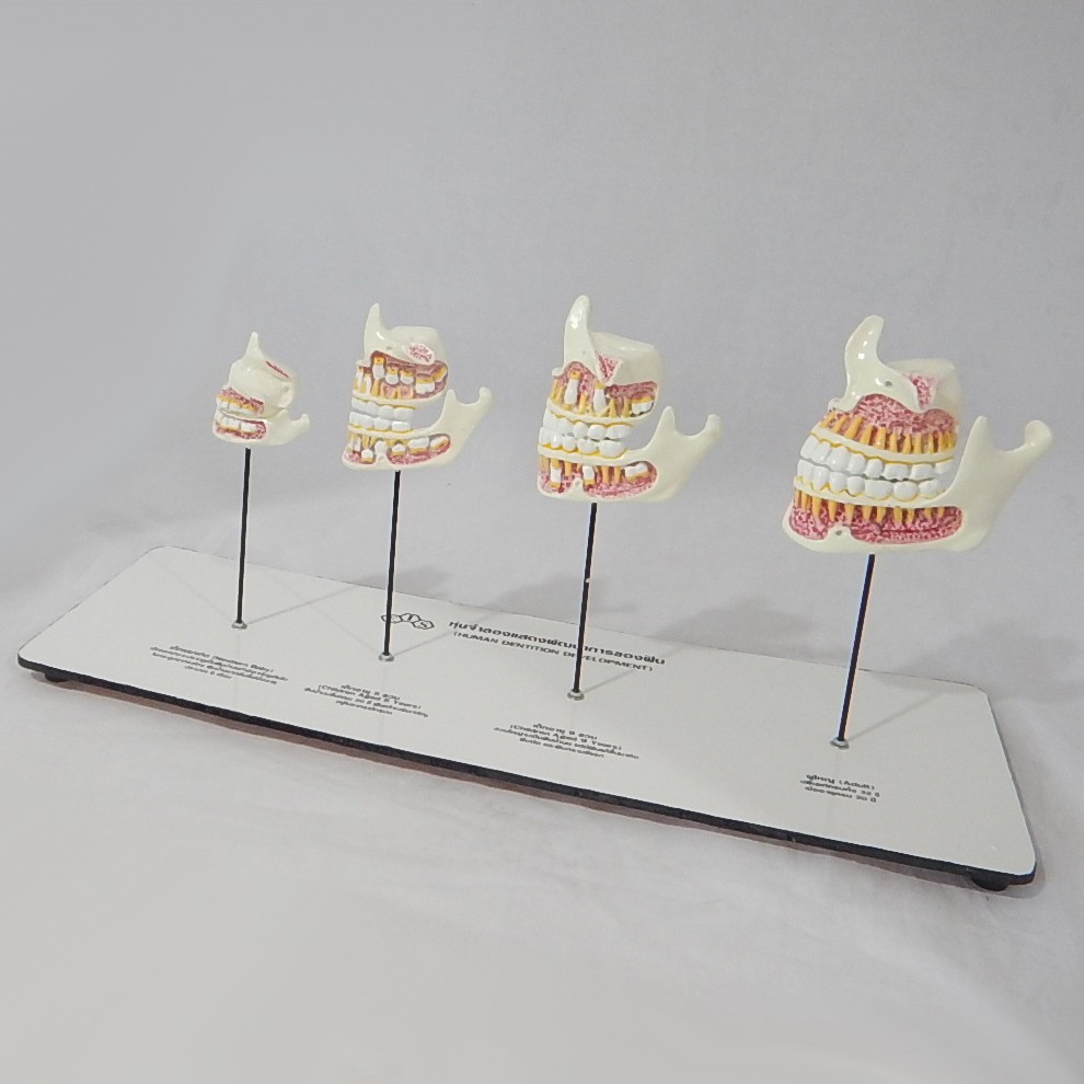 หุ่นจำลองพัฒนาการของฟัน 4 ระยะ (Human Dentition Development Model ...