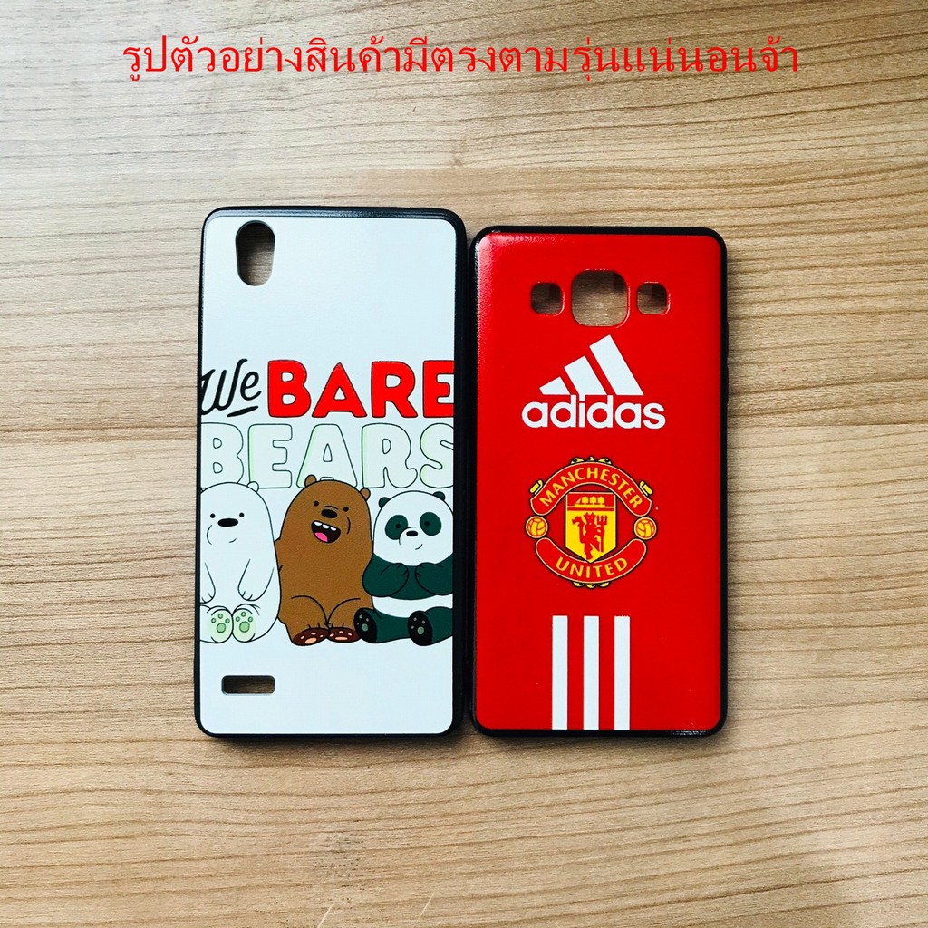 เคสตามสั่ง รูปตัวเอง XiaomiRedmi 4A / Redmi Note4 / Redmi Note5A / Note6 / Note7 / Note8 ...