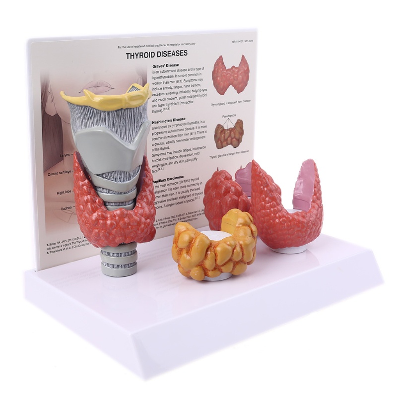 Moon Human Anatomical Thyroid Gland รุ่น Pathology Anatomy ระบบย่อย ...