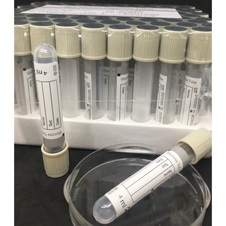 หลอดเก็บเลือด:Sodium Fluoride(NaF),Nonvac Tube(จุกสีเทา)หลอดบรรจุสิ่ง ...