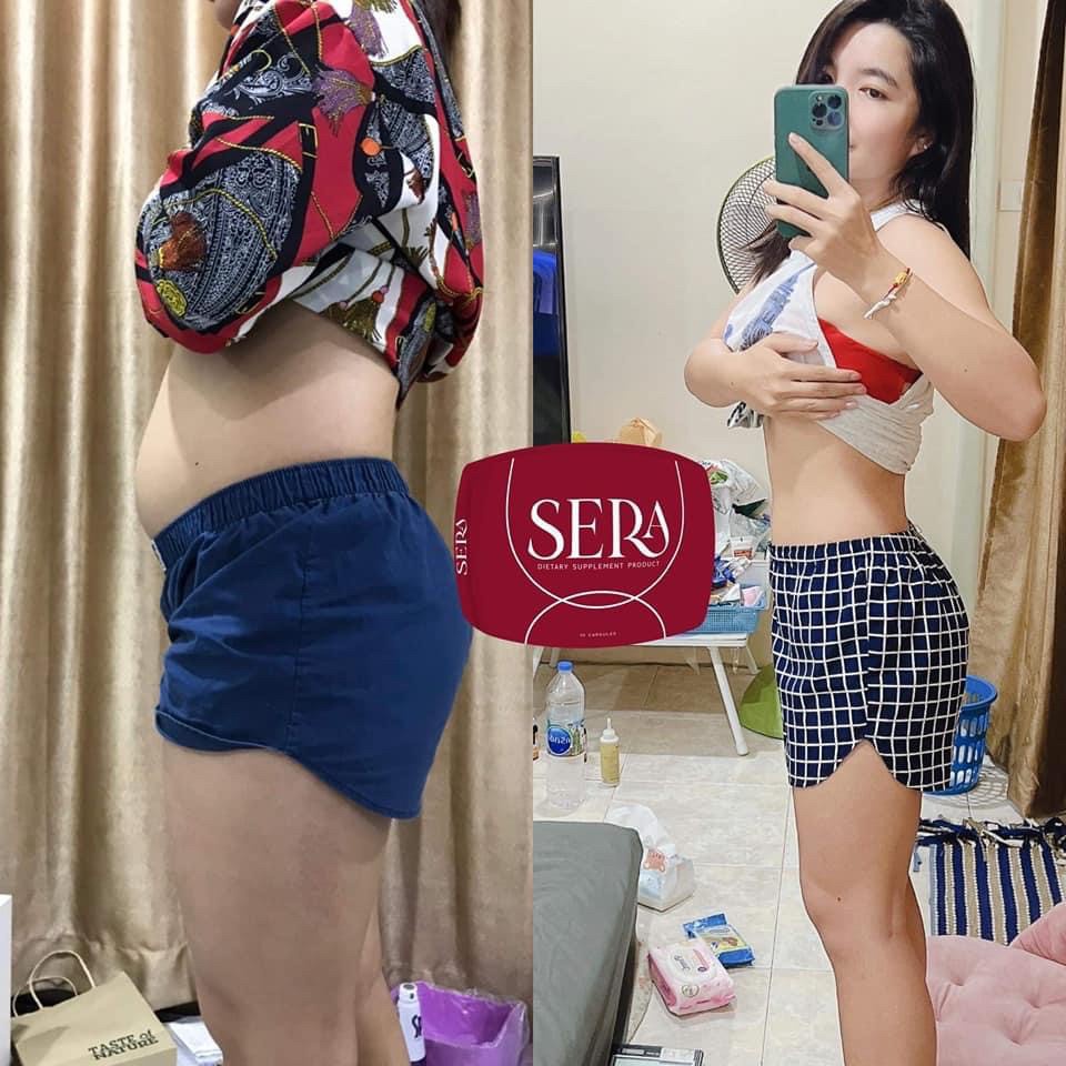 #ของแท้ Sera by Sowi เซร่า โซวี่ อาหารเสริมลดน้ำหนัก เร่งด่วน สูตรดื้อยา ลดยาก อ้วนกรรมพันธุ์ ...
