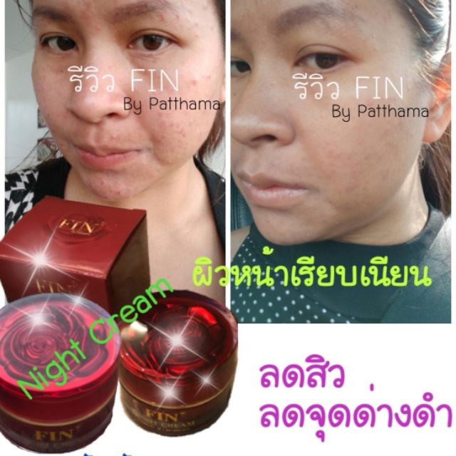 Fin night cream | Shopee Thailand