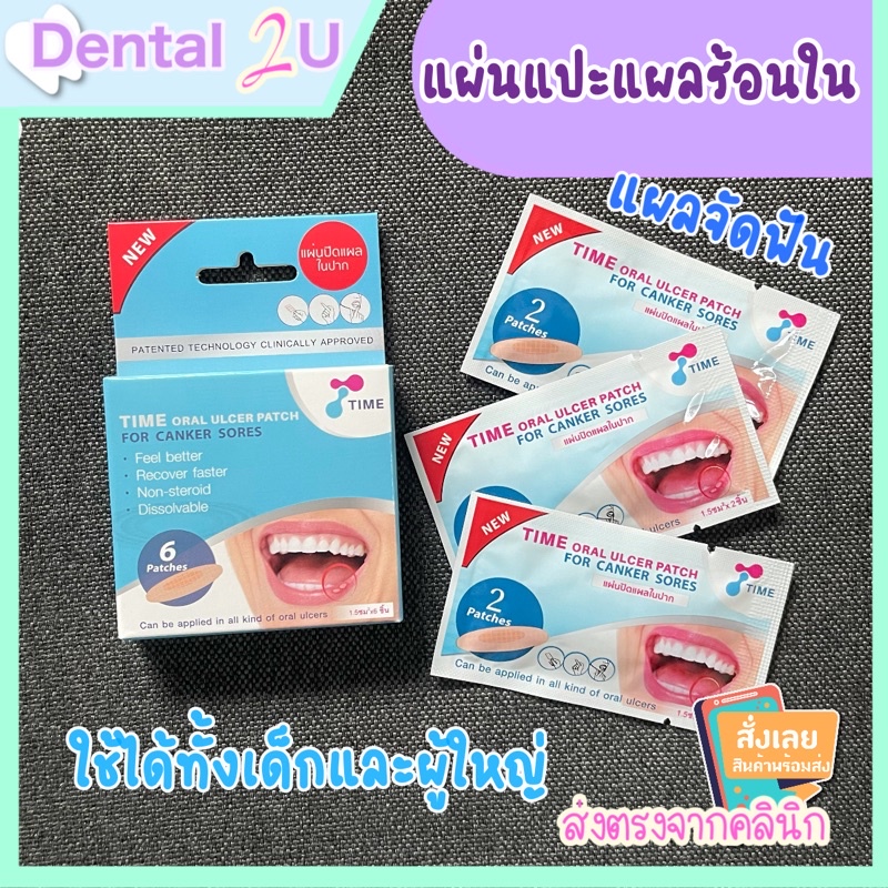 Time oral ulcer patch แผ่นแปะแผลในปาก แผลร้อนใน | Shopee Thailand