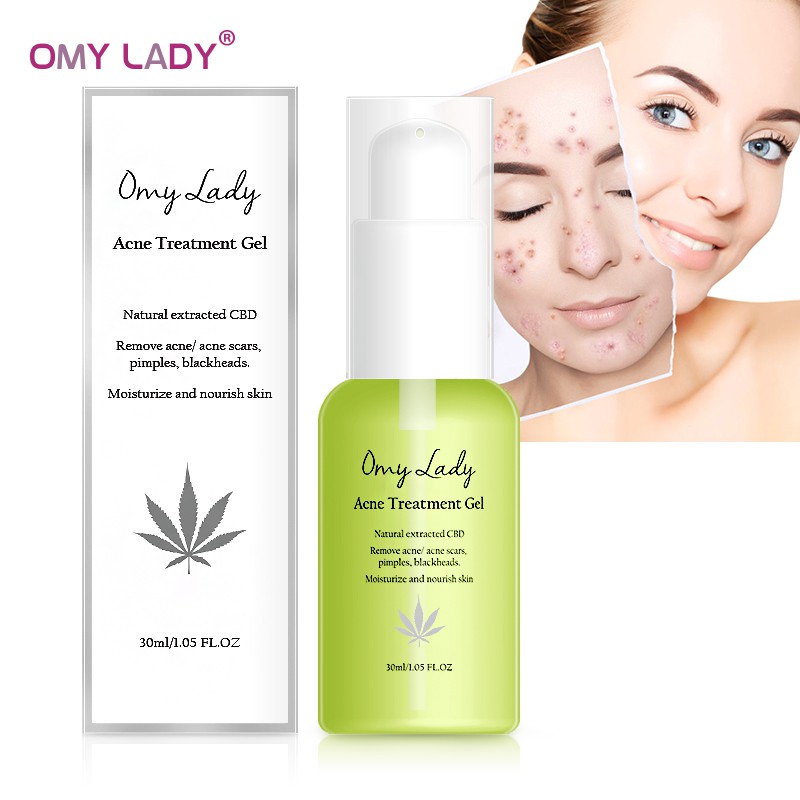 OMY LADY เซรั่มรักษาสิว 30 มล. | Shopee Thailand