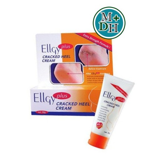 Ellgy Plus Cracked Heel Cream เอลจี พลัส ครีมทาส้นเท้าแตก บำรุงเท้า ...