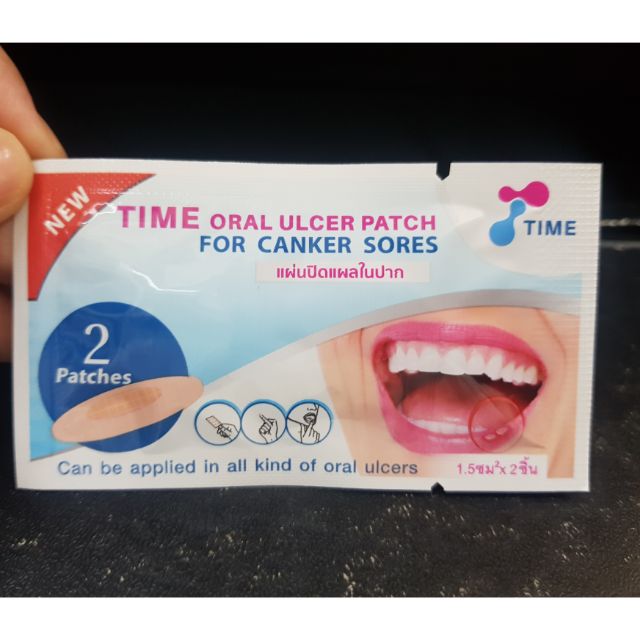 TIME Oral Ulcer Patch l แผ่นปิดแผลในปาก 1 ซอง 2 ชิ้น | Shopee Thailand