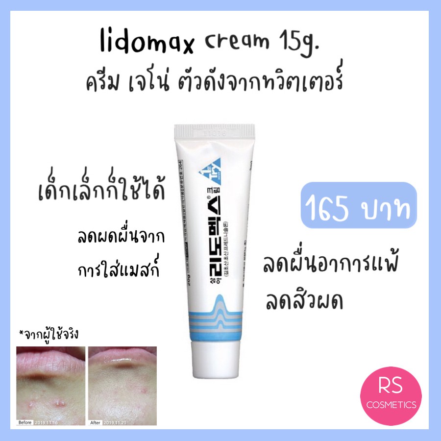 (ของแท้ 100% พร้อมส่ง) lidomax cream 15g. ครีมเจโน่จากทวิตเตอร์ แต้มสิว ...