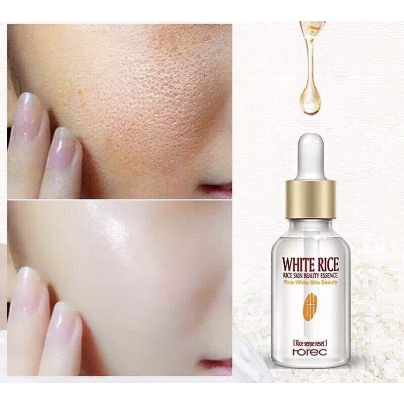 เซรั่มน้ำนมข้าว ผิวขาวใส ผิวเรียบเนียน Horec White Rice Skin Beauty