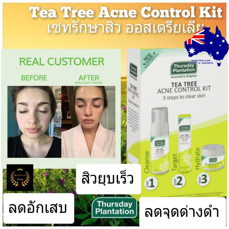 Thursday Plantation Tea Tree Oil Acne Control Kit ทีทรีออย ทีทีออยส์ ท ...