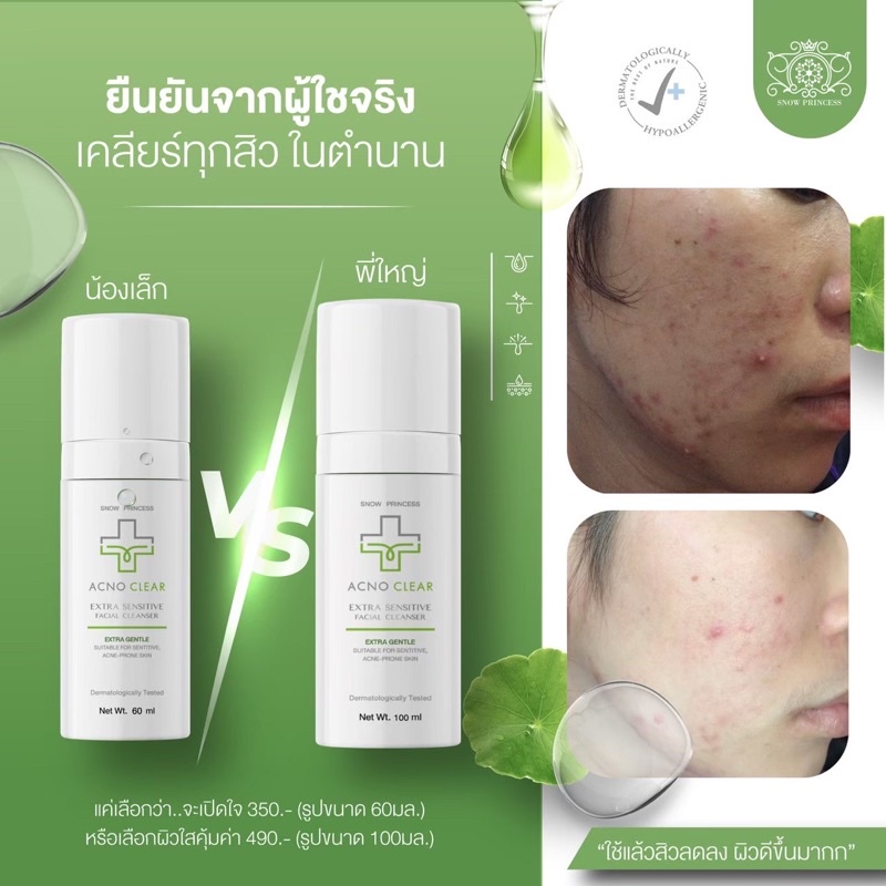 ส่งฟรี มีปลายทาง Acno Clear Cleanser เจลล้างหน้าลดสิว ใช้ได้กับทุกสภาพ ...