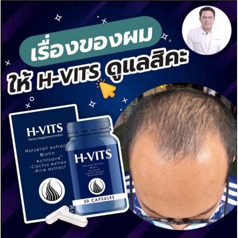 H-vits plus วิตามินผมแก้ปัญหาผมร่วง ทั้งคุณผู้ชายและคุณผู้หญิง | Shopee ...