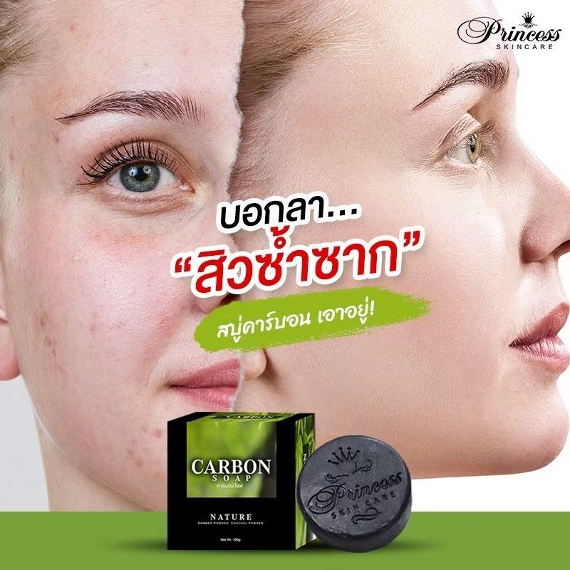 สบู่ดำ ดีท๊อกหน้า (CARBON SOAP) | Shopee Thailand