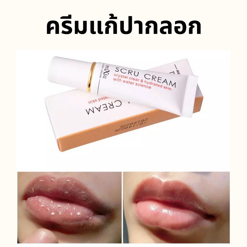 SCRU CREAM ใครปากลอกหนักๆ ห้ามผ่านค่ะ นำเข้าจากไต้หวัน | Shopee Thailand