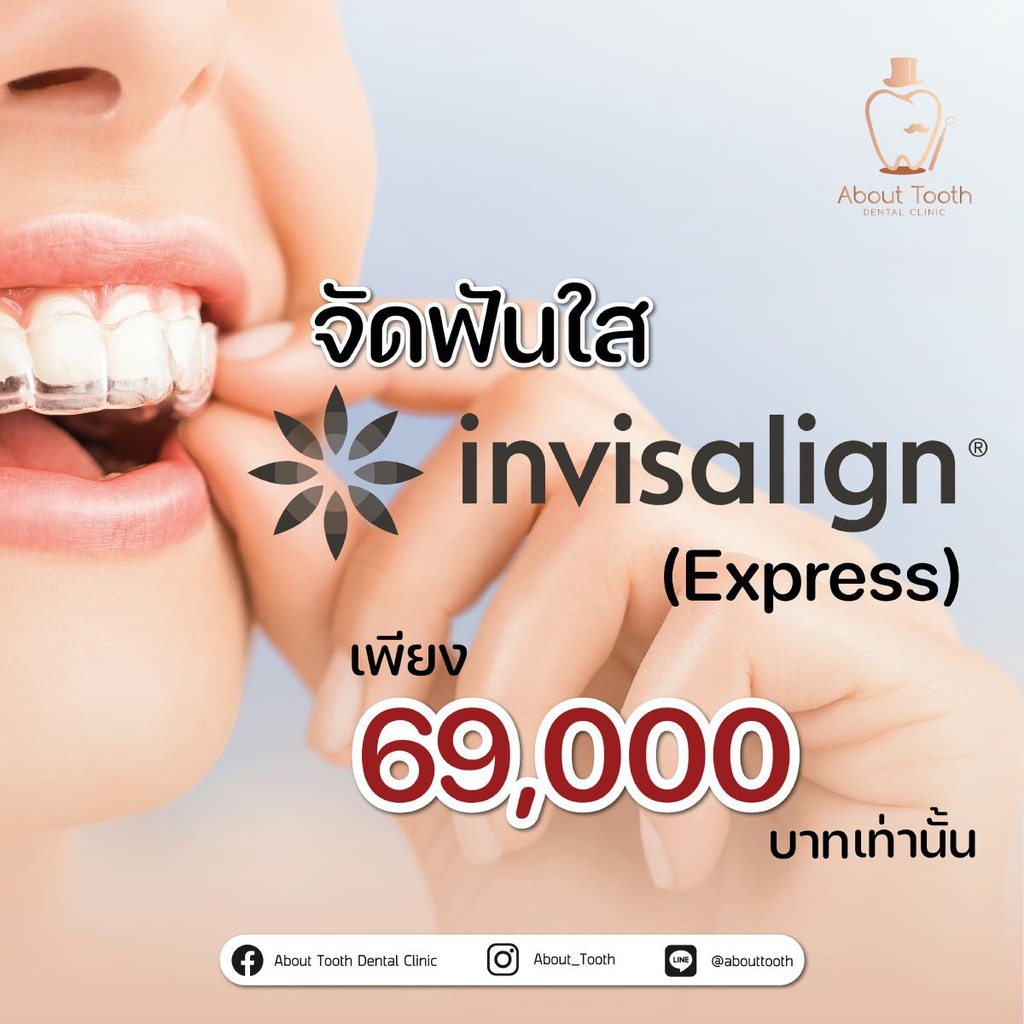 คอร์สจัดฟันแบบใส Invisalign Express ฟันบนหรือล่าง | Shopee Thailand