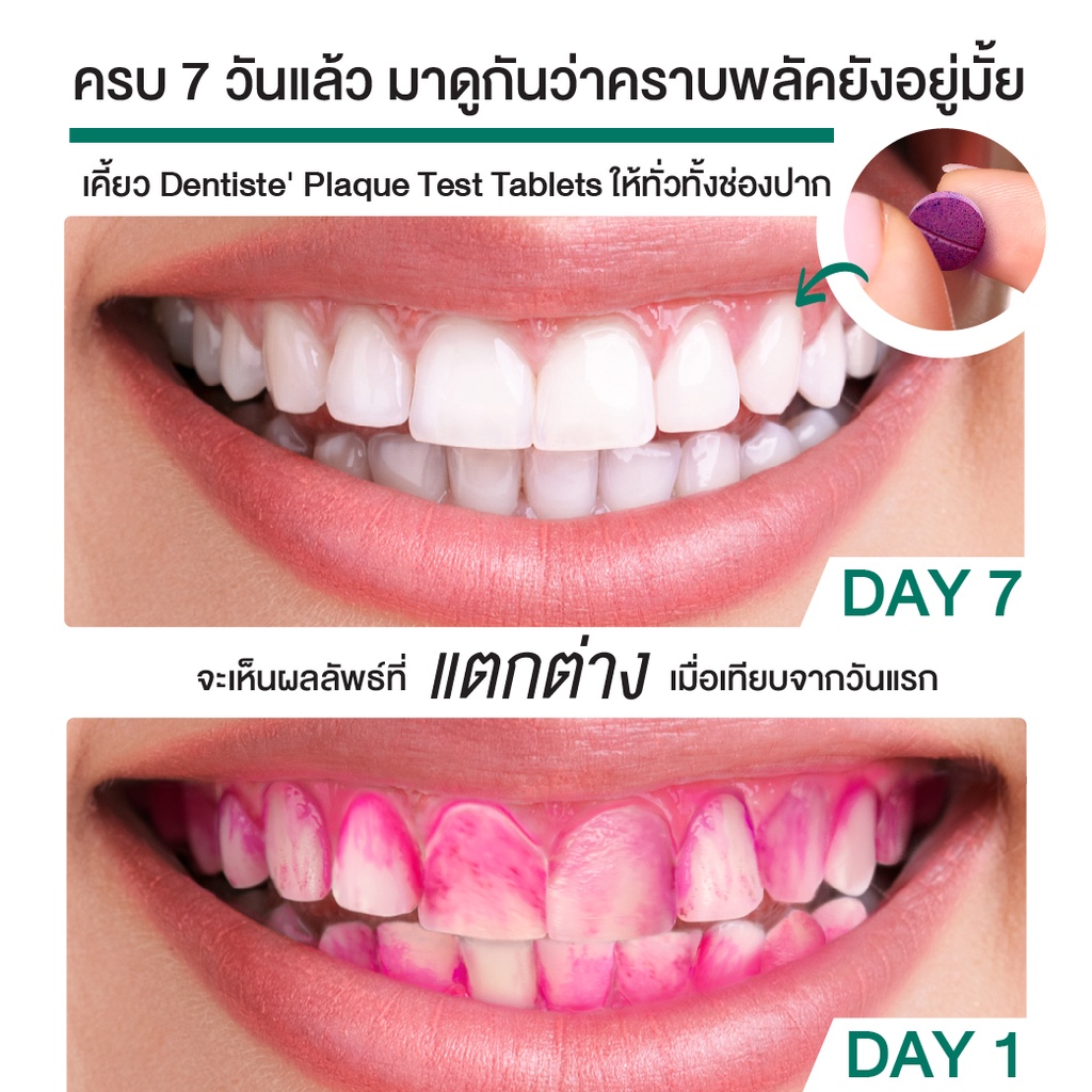 [สินค้าขายดี] Dentiste' Plaque Test เม็ดม่วง สำหรับเคี้ยว ทดสอบคราบพลัค ...