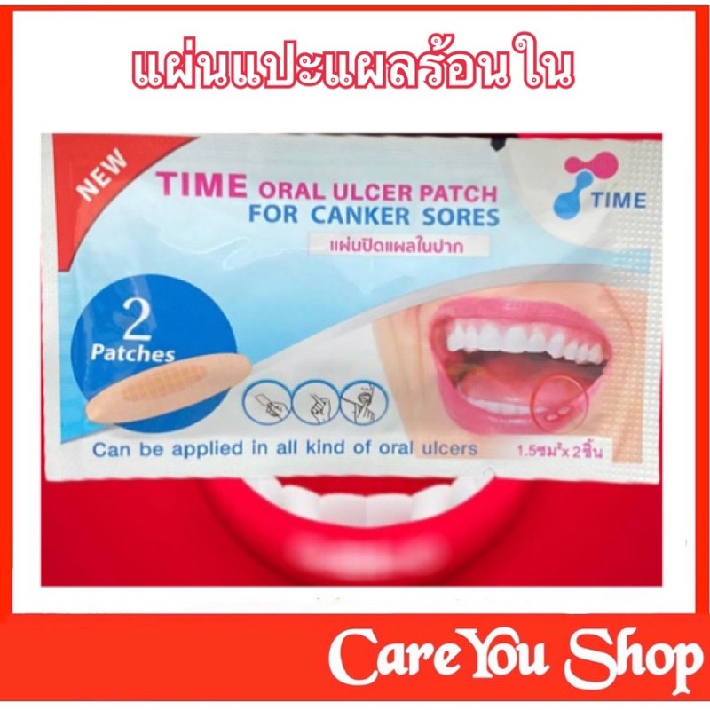 แผ่นแปะร้อนใน TIME ORAL ULCER PATCH แผลร้อนใน แผ่นแปะ แปะแล้วละลายได้ ...