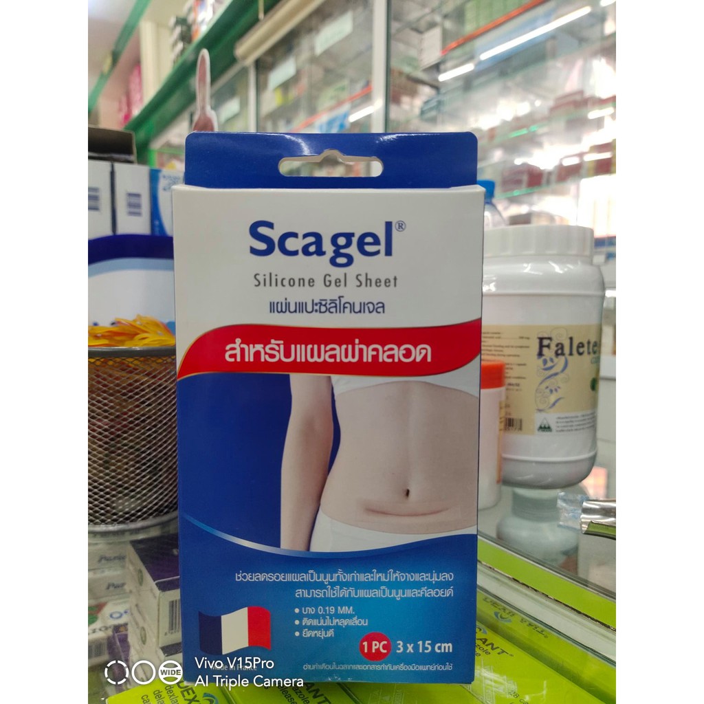 SCAGEL SILICONE GEL SHEET แผ่นแปะซิลิโคนเจล สำหรับแผลผ่าคลอด | Shopee ...