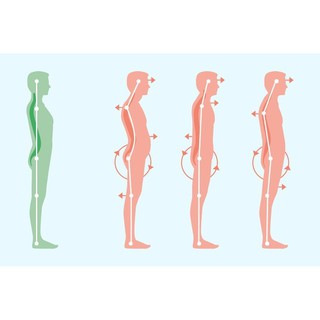 Postural Analysis Grid Chart | Shopee Thailand