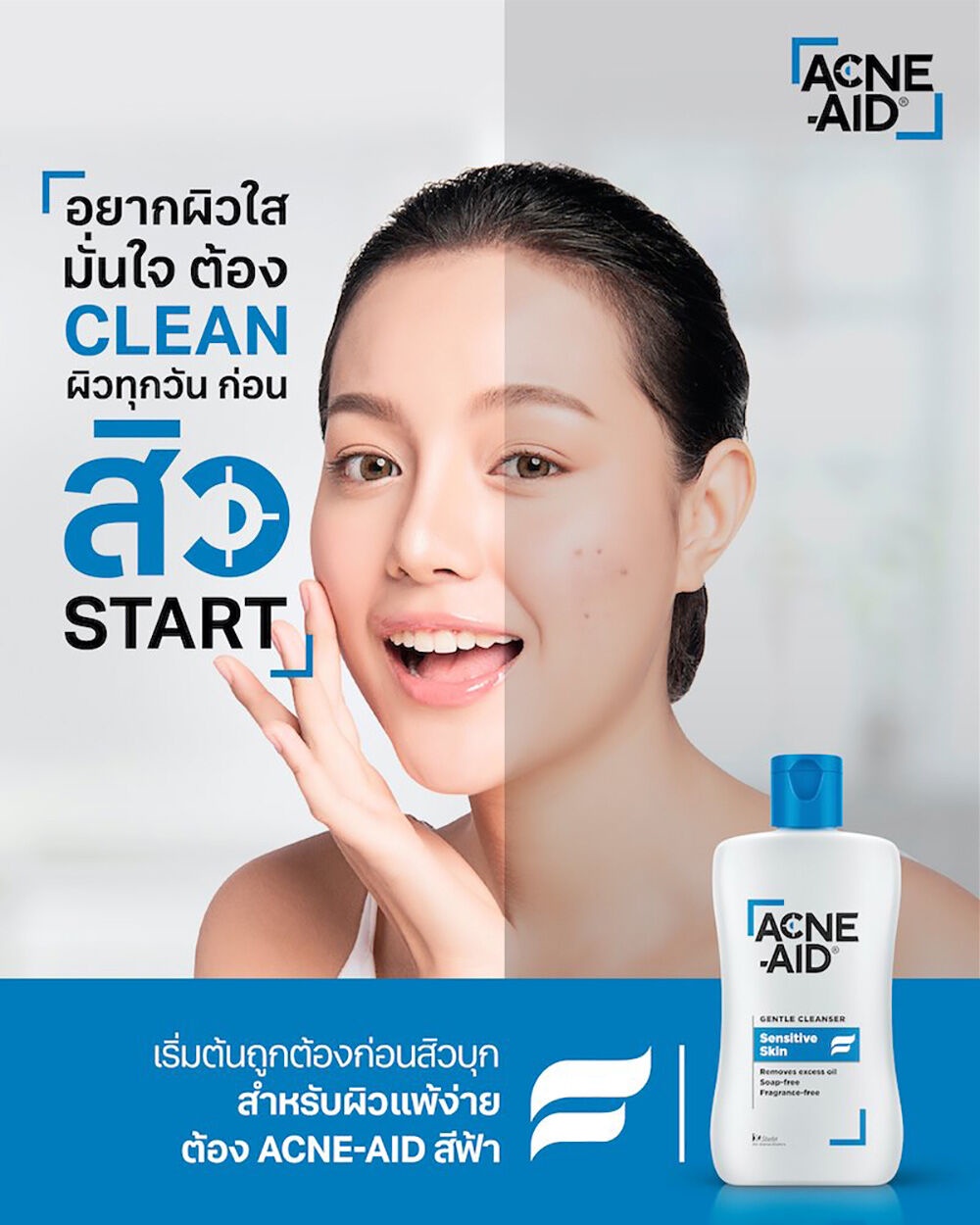 ACNE-AID Gentle Cleanser แอคเน่-เอด ผลิตภัณฑ์ทำความสะอาดผิวหน้า สำหรับ ...