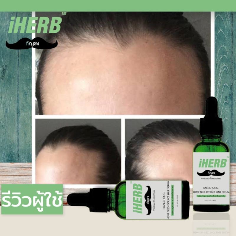 กัญชง แฮร์ เซรั่ม iherb | Shopee Thailand