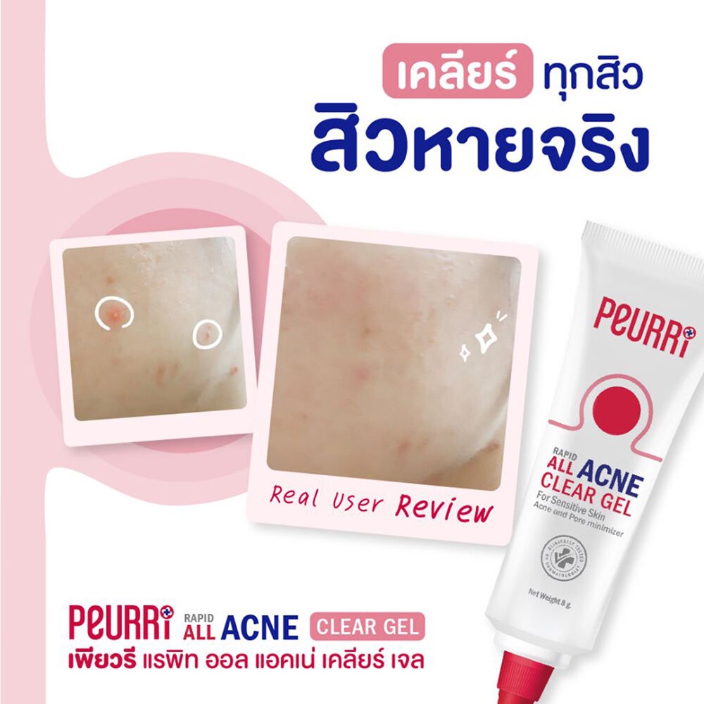 Peurri Rapid All Acne Clear Gel 8g เพียวรี เจลแต้มสิว. | Shopee Thailand