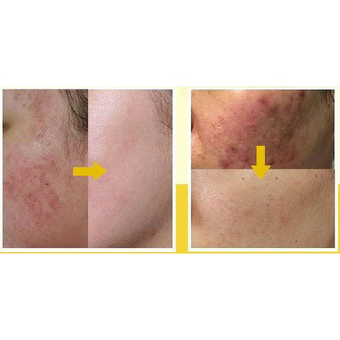ใหม่[ความงามและของใช้ส่วนตัว] [ผลิตภัณฑ์ดูแลผิวหน้า] ของแท้/พร้อมส่ง ...