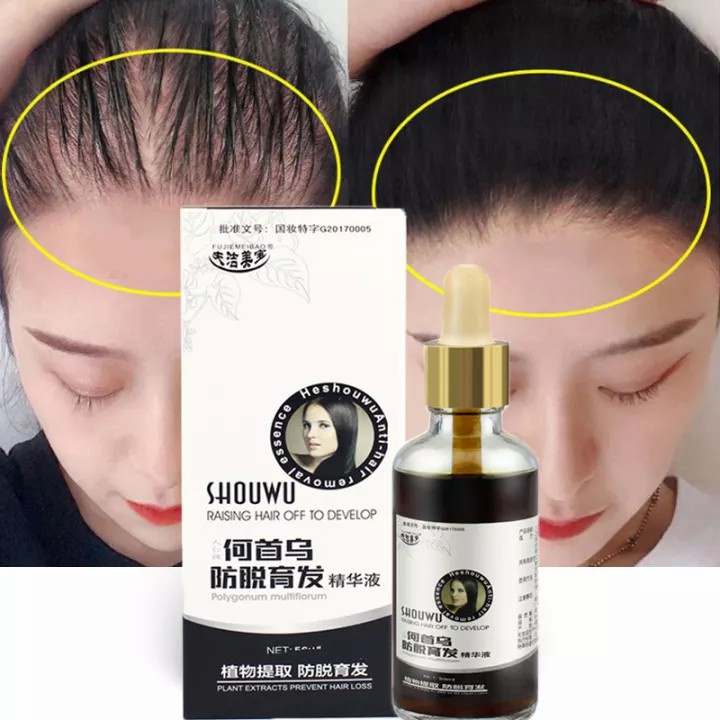 MOLI Fu Jie Meibao Polygonum multiflorum anti-hair loss Essence โลชั่น ...