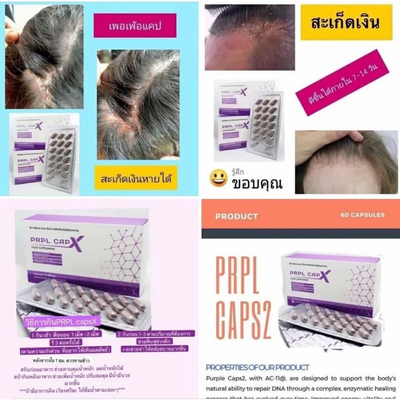 PRPL capx food supplement | Shopee Thailand