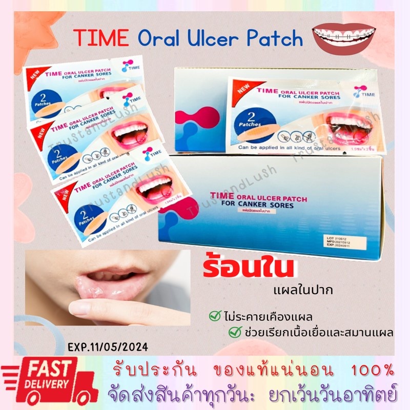 Time oral ulcer patch แผ่นแปะแผลในปาก แผลร้อนใน แก้ปวดแผลกัด แผลกระแทก ...