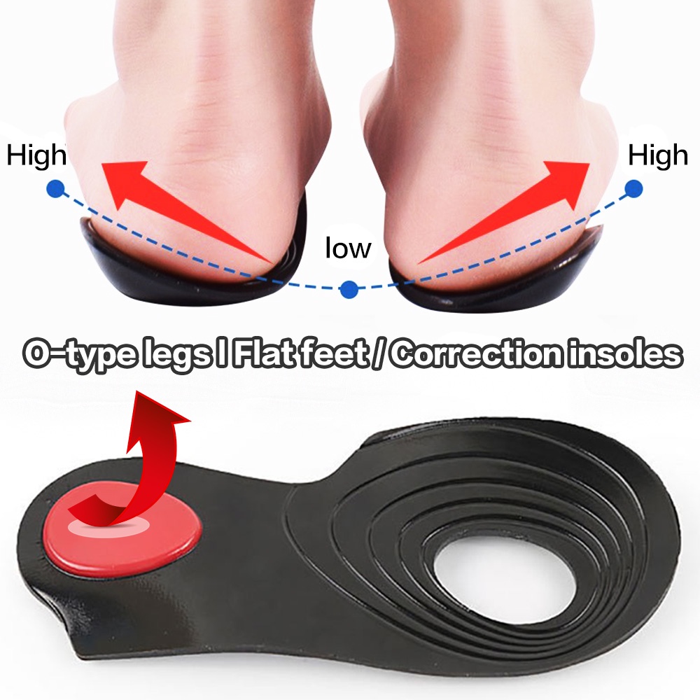 1 คู่ Flat Foot Corrector Gel Insole Cure เท้าแบน O/X ขา Arch รองรับ 3 ...