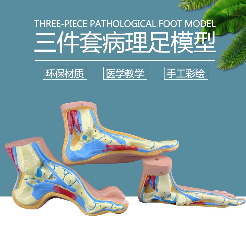 โมเดลหุ่นอนาโตมี่ Normal Foot Flatfoot Bow Foot Model Foot Pathology ...