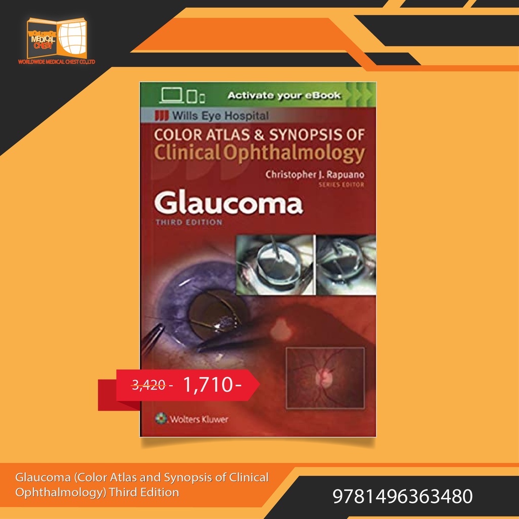 Glaucoma (Color Atlas and Synopsis of Clinical Ophthalmology) | Shopee ...