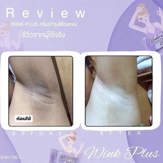 Wink Plus(underarm cream) | Shopee Thailand