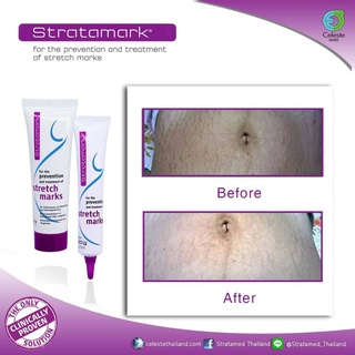 Stratamark(สีม่วง) 20g + Stratamark(สีม่วง) 20g | Shopee Thailand