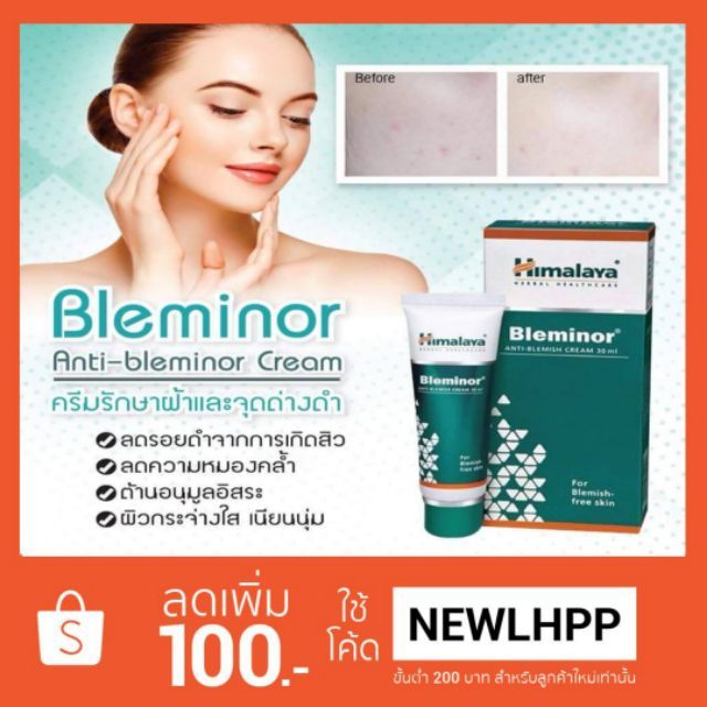 Himalaya Bleminor Anti-Blemish Cream 30 ml | Shopee Thailand