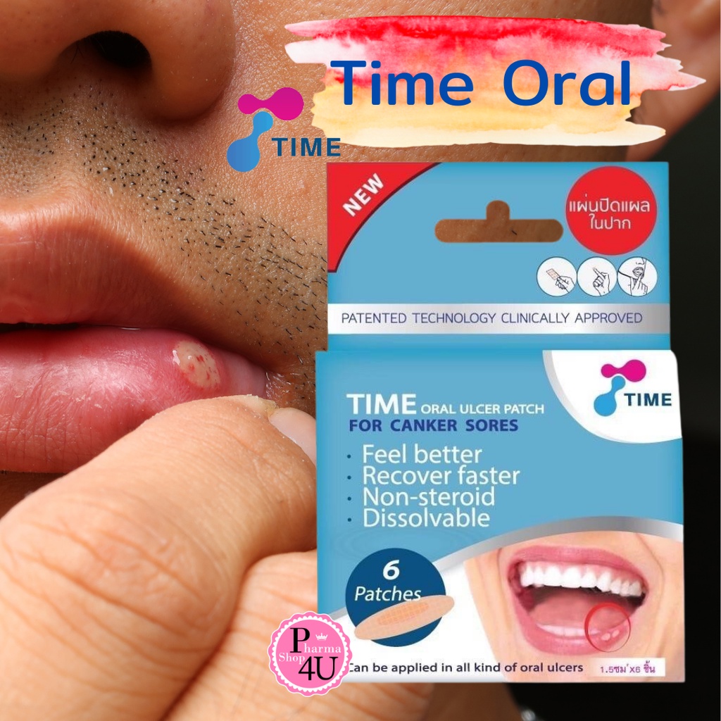 แผ่นแปะแผลร้อนใน TIME ORAL ULCER PATCH 6 ชิ้น แผลในปาก | Shopee Thailand