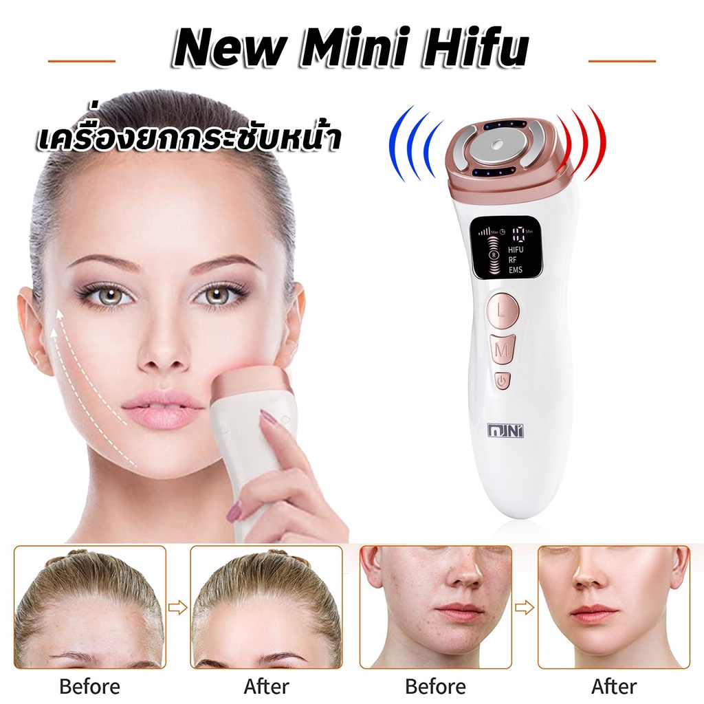 เครื่อง MINI HIFU Gen2 มินิไฮฟู ยกกระชับหน้า ทำหน้าเรียว กรอบหน้าชัด ลด ...