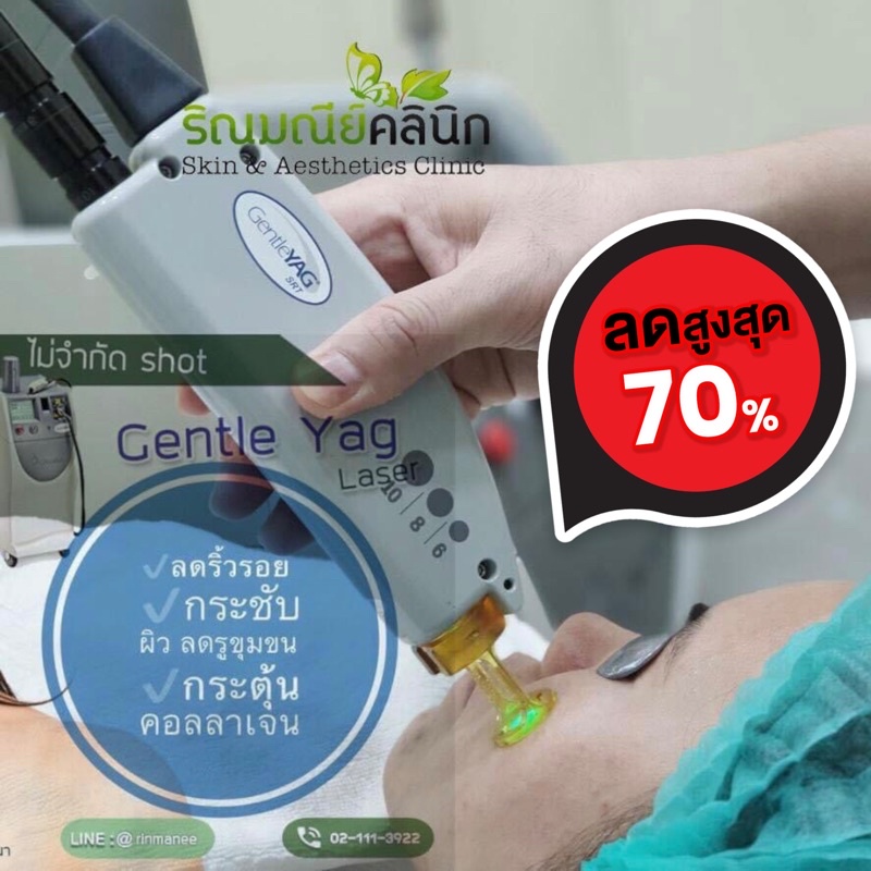 เลเซอร์หน้า Gentle Yag Reju เลเซอร์ Long Pulse Nd:YAG ปรับสภาพผิวหน้า ...