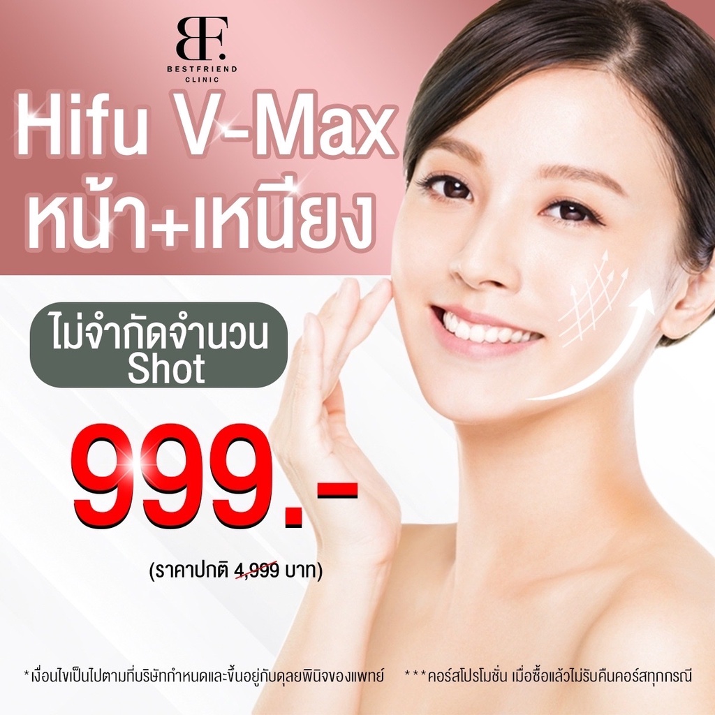Hifu V-Max หน้า + เหนียง ยิงไม่จำกัด Shot. | Shopee Thailand