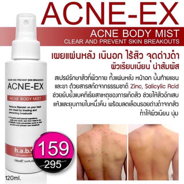 ACNE-EX 120ml 🇺🇸 ปัญหาสิวที่หลัง สิวผด ที่หลัง คอ ต้นแขน ลดรอยดำจากสิว ...