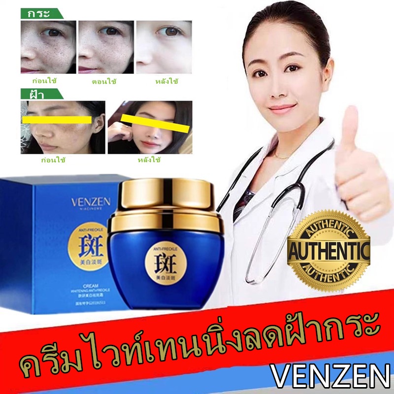 (เห็นผลเร็ว/ของแท้) VENZEN Whitening Anti-Freckle Cream ครีมทาฝ้า ครีม ...