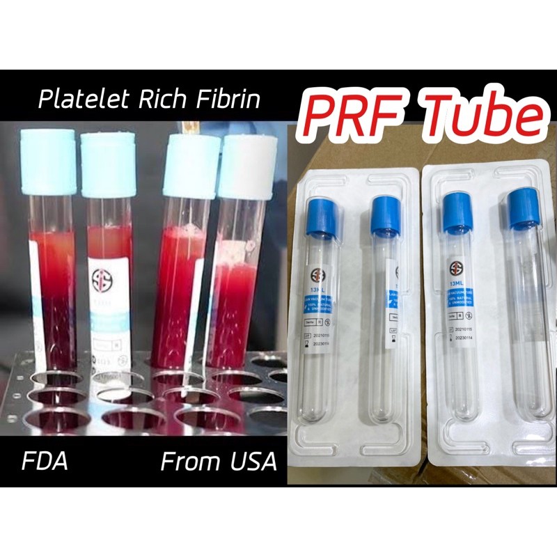 (แพคคู่)PRF Tube PRF หลอดเลือดสำหรับสกัด Platelet+Growth Factor+Rich ...