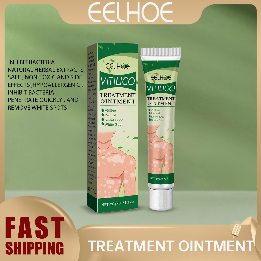 Eelhoe Vitiligo ครีมไวท์เทรทเมนต์ รักษาโรค ลดจุดด่างดํา ให้ความชุ่มชื้น ...
