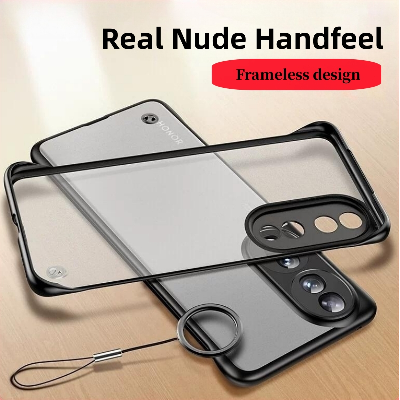 Honor X9C 90 GT 70 50 200 Pro 200 Lite 100 20 Pro Magic 6 Pro 5 Pro 4 Pro 3 Pro เคสโทรศัพท์ ...