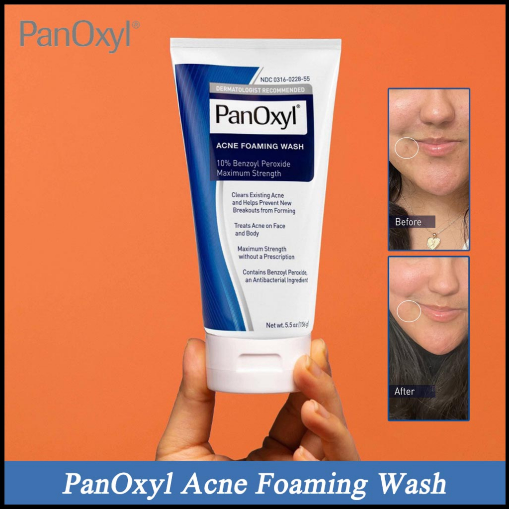 PanOxyl Acne Foaming Wash 10% Benzoyl Peroxide Maximum Strength 156g ...