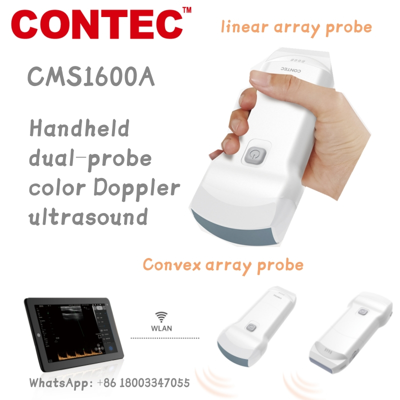 Contec CMS1600A เครื่องวินิจฉัยอัลตราซาวด์ แบบมือถือ โหมดทํางาน B B M C ...